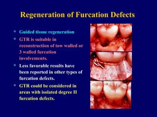 Ummairah | PPT | Dental Health | Diseases and Conditions
