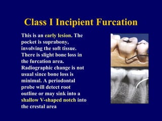 Ummairah | PPT | Dental Health | Diseases and Conditions