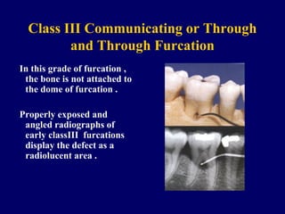 Ummairah | PPT | Dental Health | Diseases and Conditions
