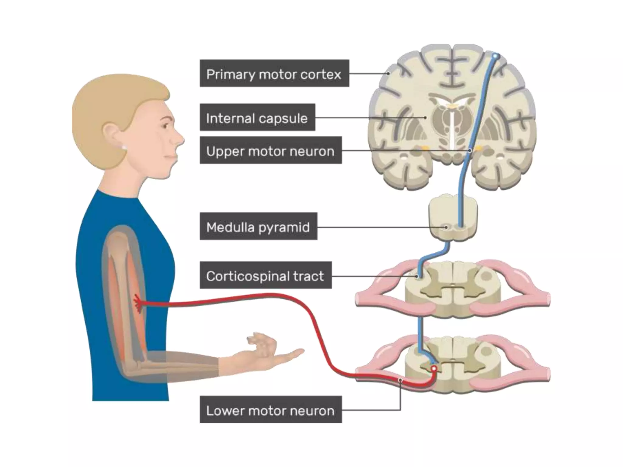 Upper Motor Neuron, Lower Motor Neuron and Brown Sequard Syndrome | PPTX