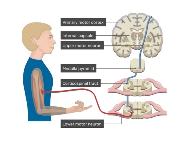 Upper Motor Neuron, Lower Motor Neuron and Brown Sequard Syndrome ...