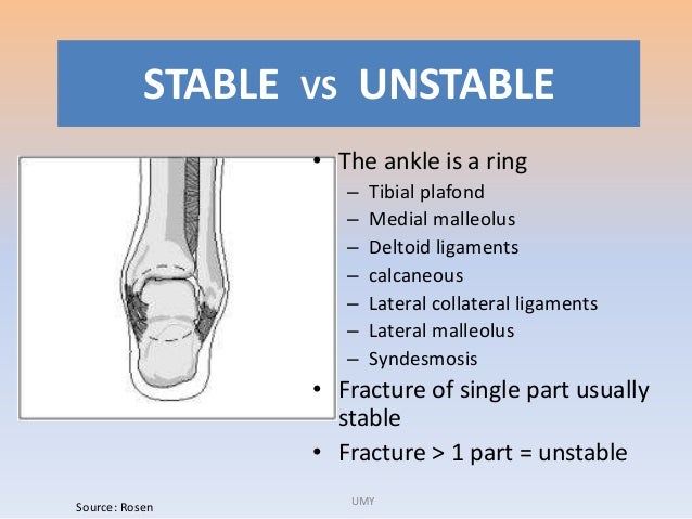 ANKLE FRACTURES