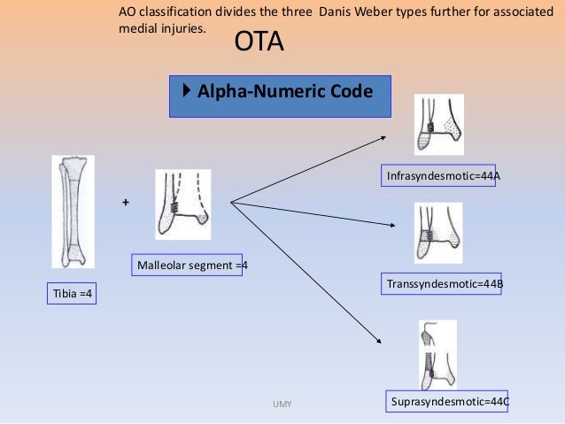 ANKLE FRACTURES
