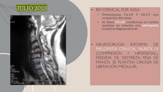 UN CASO DE MIELOPATIA EN LA COLUMNA CERVICAL.pdf