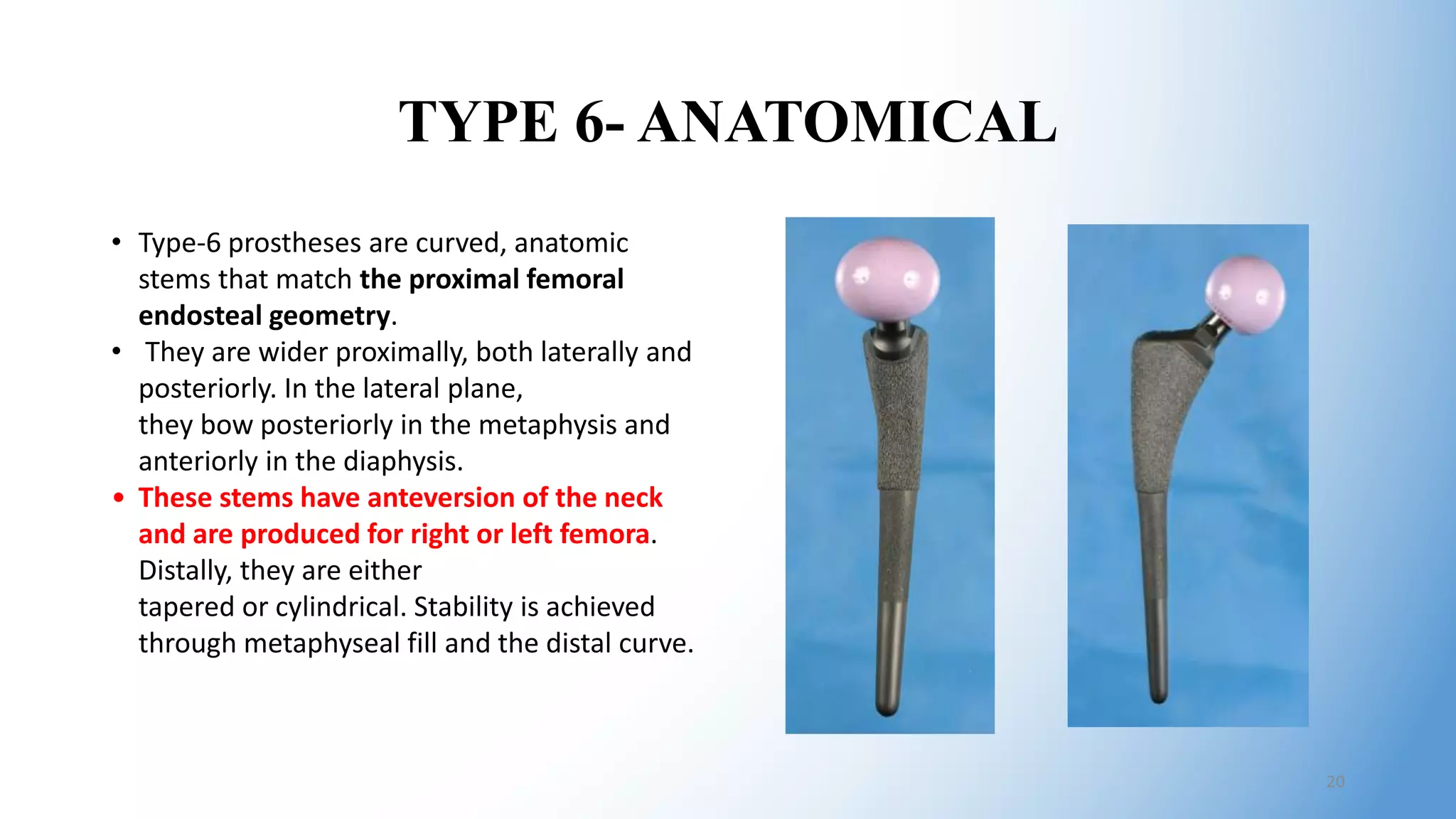 Uncemented femoral stem | PPTX