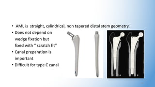 Uncemented femoral stem | PPTX