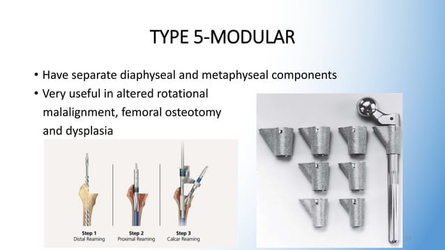 Uncemented femoral stem | PPTX
