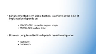 Uncemented femoral stem | PPTX