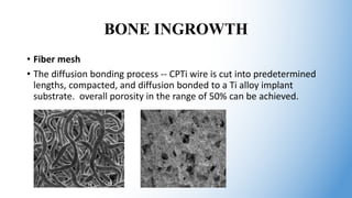 Uncemented femoral stem | PPTX