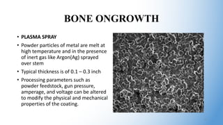 Uncemented femoral stem | PPTX