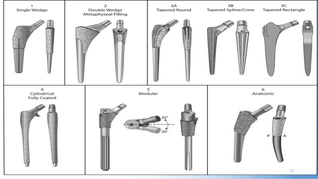Uncemented femoral stem