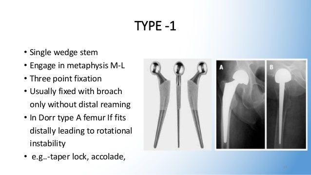 Uncemented femoral stem