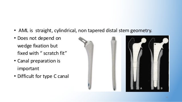 Uncemented femoral stem