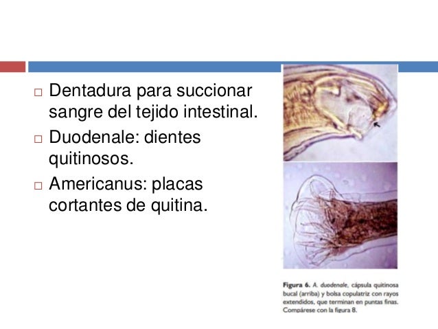 Uncinariasis O Anquilostomiasis Informacin Prctica