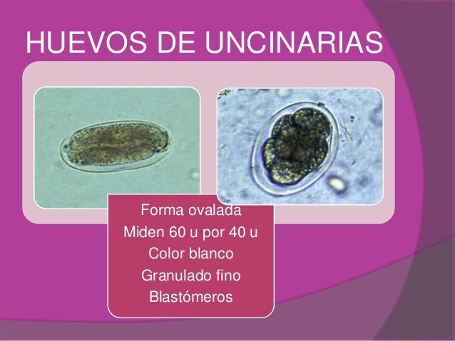 Uncinariasis