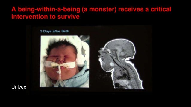 Uncommon obstetrical procedures