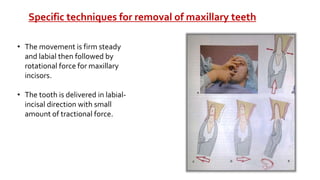 Uncomplicated exodontia | PPTX