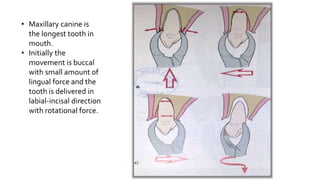Uncomplicated exodontia | PPTX