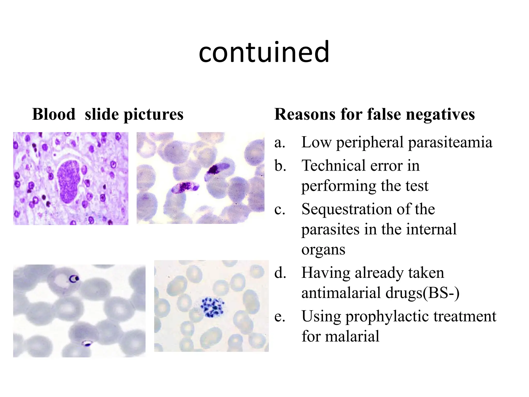 UNCOMPLICATED MALARIA dr kuule pathology | PPT