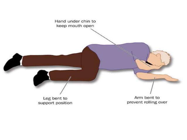 first aid management of patient with unconsciousness