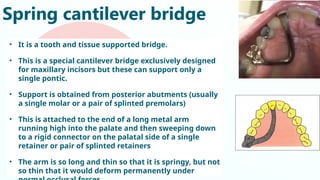 UNCONVENTIONAL BRIDGES: INNOVATIVE APPROACH IN MODERN PROSTHODONTICS.pptx