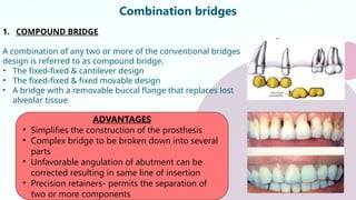 UNCONVENTIONAL BRIDGES: INNOVATIVE APPROACH IN MODERN PROSTHODONTICS.pptx