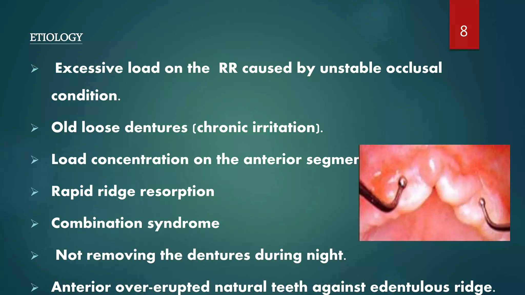 UNCONVENTIONAL DENTURES | PPTX