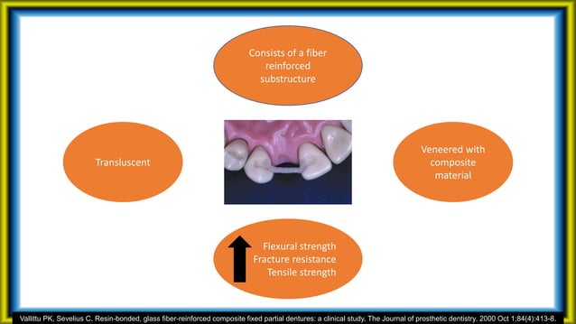Unconventional fixed partial dentures | PPTX