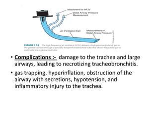 Unconventional mode of ventilation sk.pptx