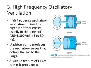 Unconventional mode of ventilation sk.pptx