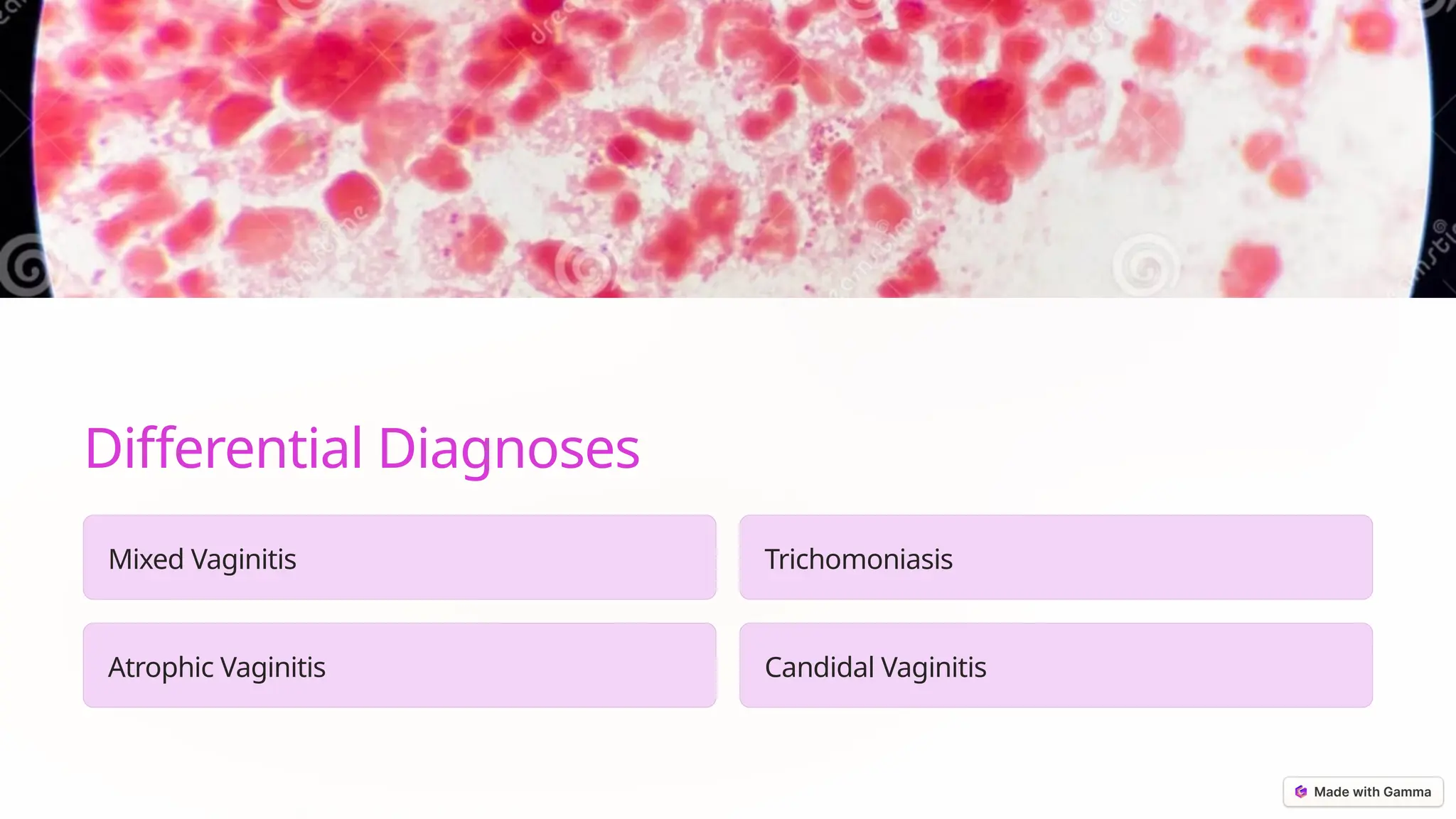 PID:Understanding-Bacterial-Vaginosis.pptx