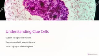 PID:Understanding-Bacterial-Vaginosis.pptx