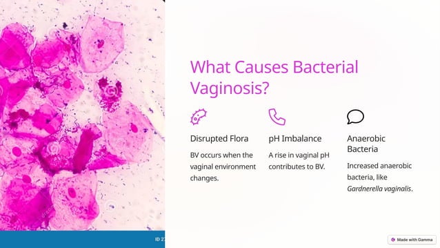 PID:Understanding-Bacterial-Vaginosis.pptx