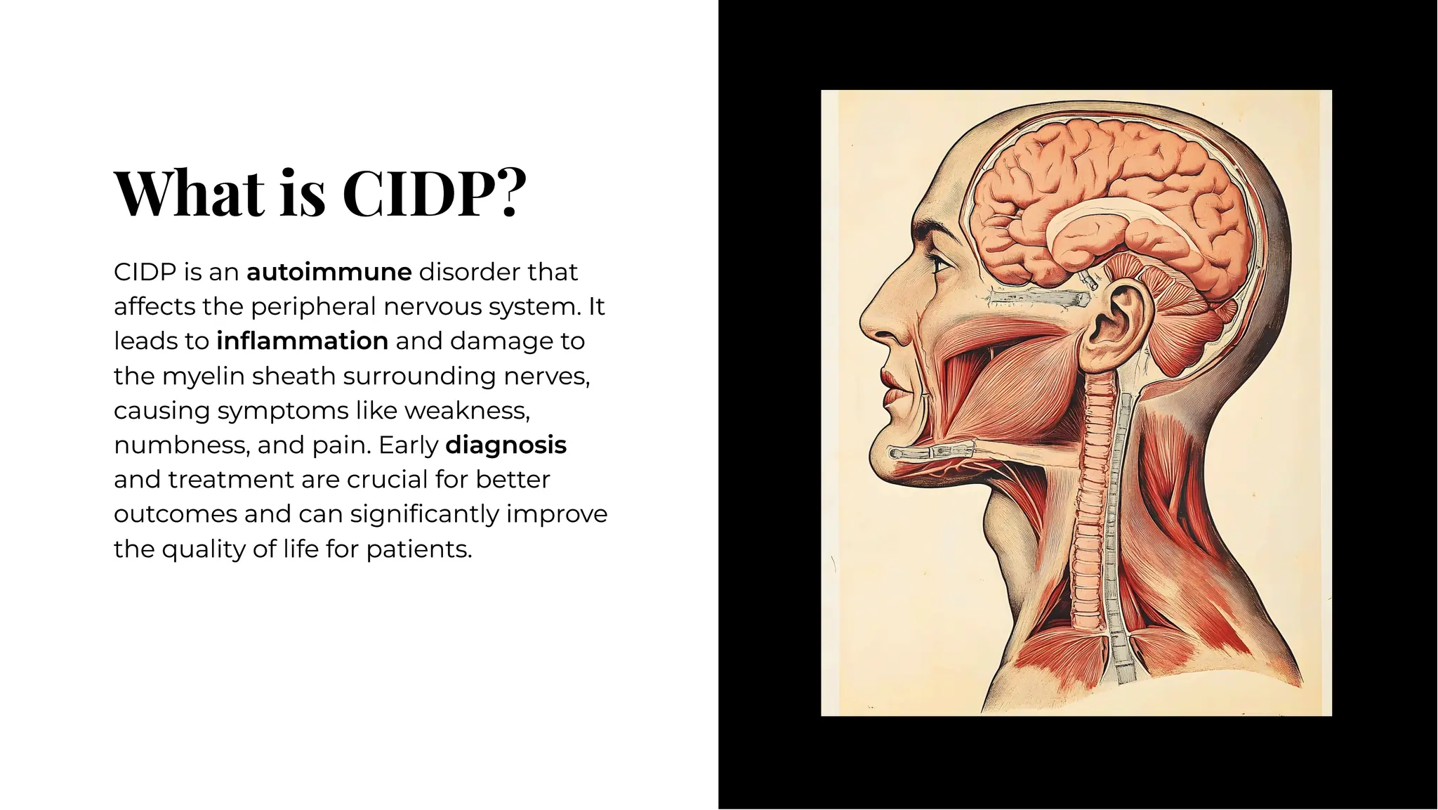 Understanding-cidp-insights-into-life-expectancy-and-patient-outcomes.pdf