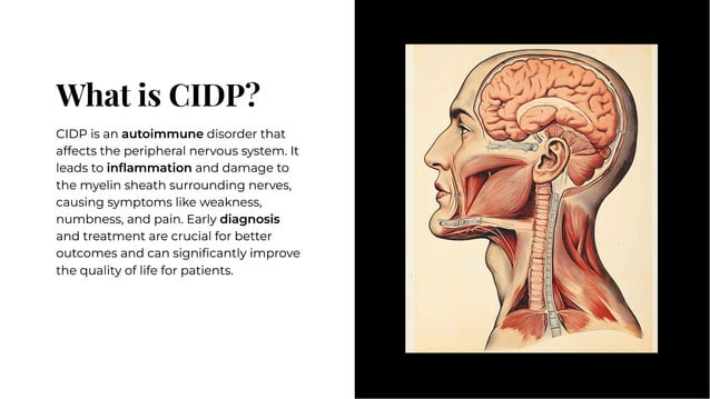 Understanding-cidp-insights-into-life-expectancy-and-patient-outcomes.pdf