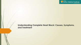 Understanding Complete Heart Block: Causes, Symptoms, and Treatment | PPTX