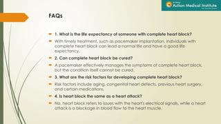 Understanding Complete Heart Block: Causes, Symptoms, and Treatment | PPTX