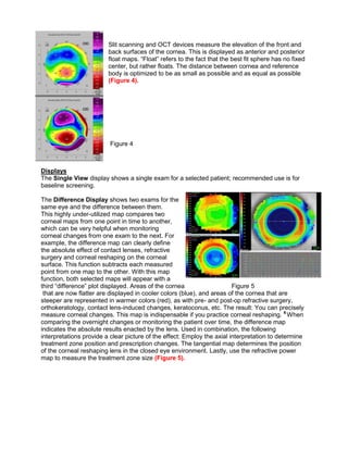 Understanding corneal-topography | PDF