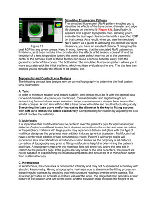 Understanding corneal-topography | PDF