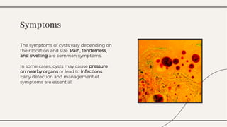 Understanding-cysts- it's Definition n types | PPT