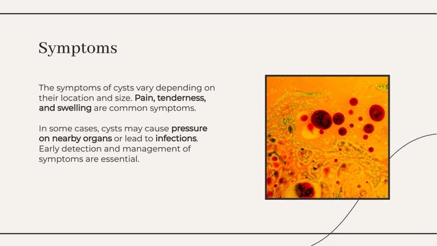 Understanding-cysts- it's Definition n types | PPT