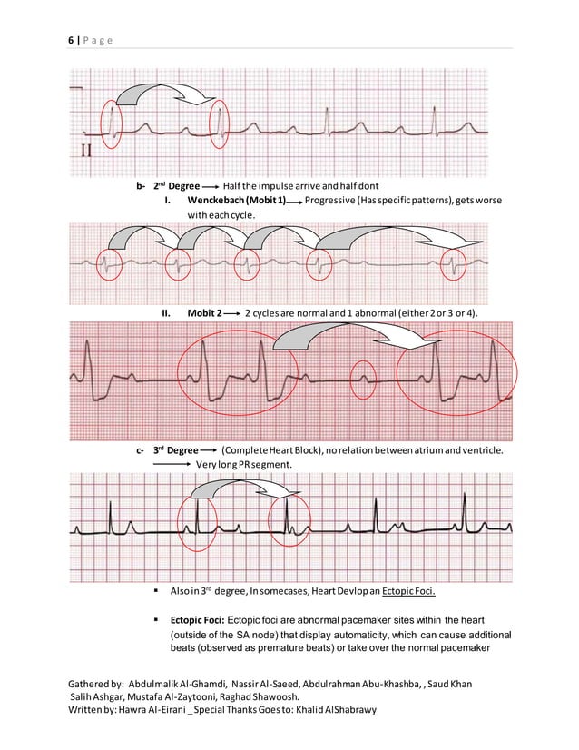 Understanding ECG | DOCX