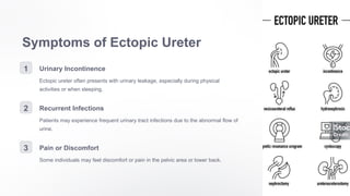 Understanding basics of -Ectopic-Ureter.pptx