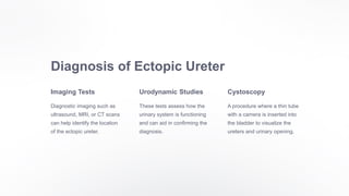 Understanding basics of -Ectopic-Ureter.pptx
