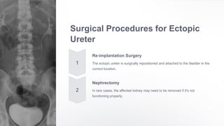 Understanding basics of -Ectopic-Ureter.pptx