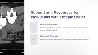 Understanding basics of -Ectopic-Ureter.pptx