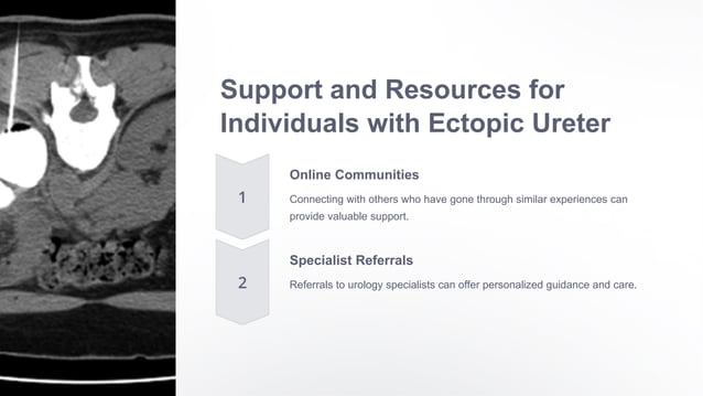 Understanding basics of -Ectopic-Ureter.pptx