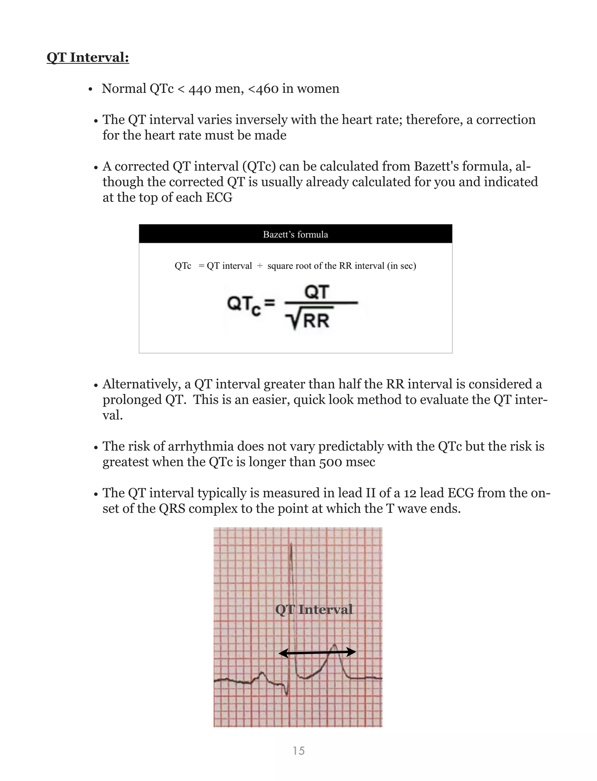 Understanding Medicine - Complete ECG Guide by Dr. Sam Gharbi | PDF