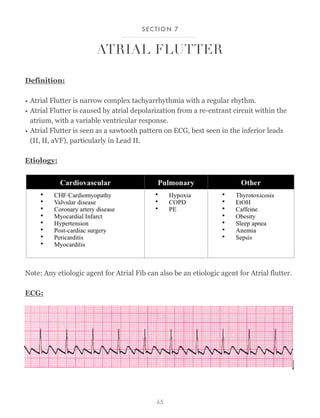 Understanding Medicine - Complete ECG Guide by Dr. Sam Gharbi | PDF