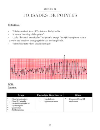 Understanding Medicine - Complete ECG Guide by Dr. Sam Gharbi | PDF